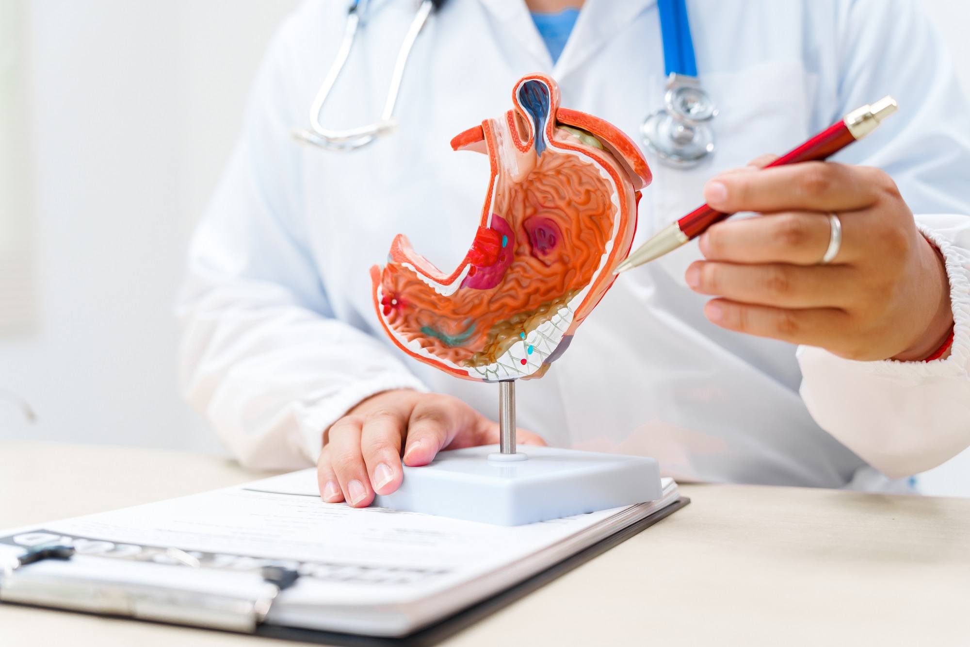 Acid Reflux Treatment & Diagnosis by Specialists in Brisbane